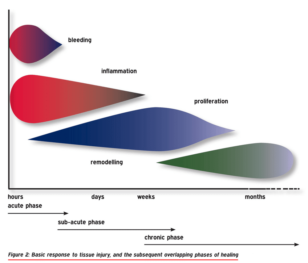 Potential Mechanisms of Low Down on Low Back Pain | Blog