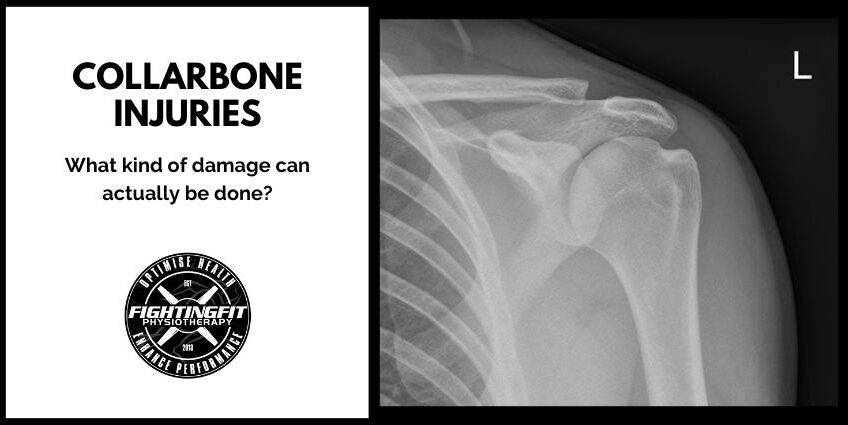 Collarbone Injuries! - Fighting Fit Physiotherapy Nerang Gold Coast
