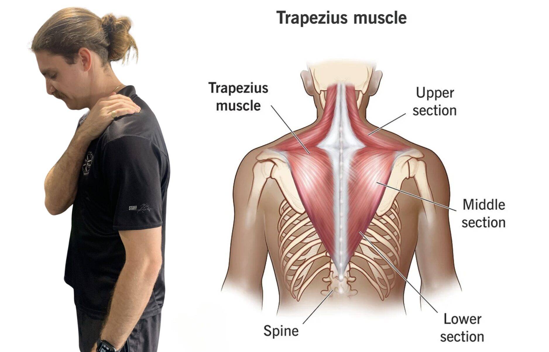 The Shocking Truth About Upper Traps: Why Weakness, Not Tightness, Is ...